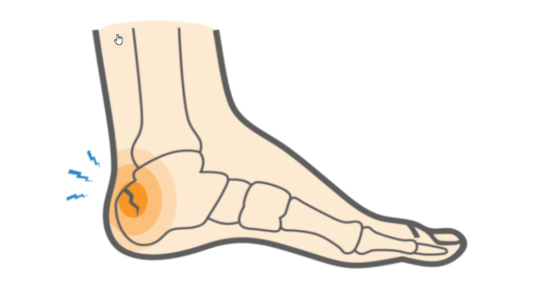The Feet, Keys to Mobility and Stability: An Exploration of the ...