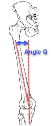 Kneecap Pain: Causes, Symptoms & How to Prevent It - OsteoMag
