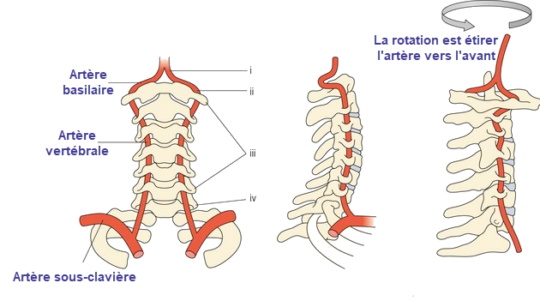 Vertebrobasilar insufficiency and cervical manipulation - OsteoMag