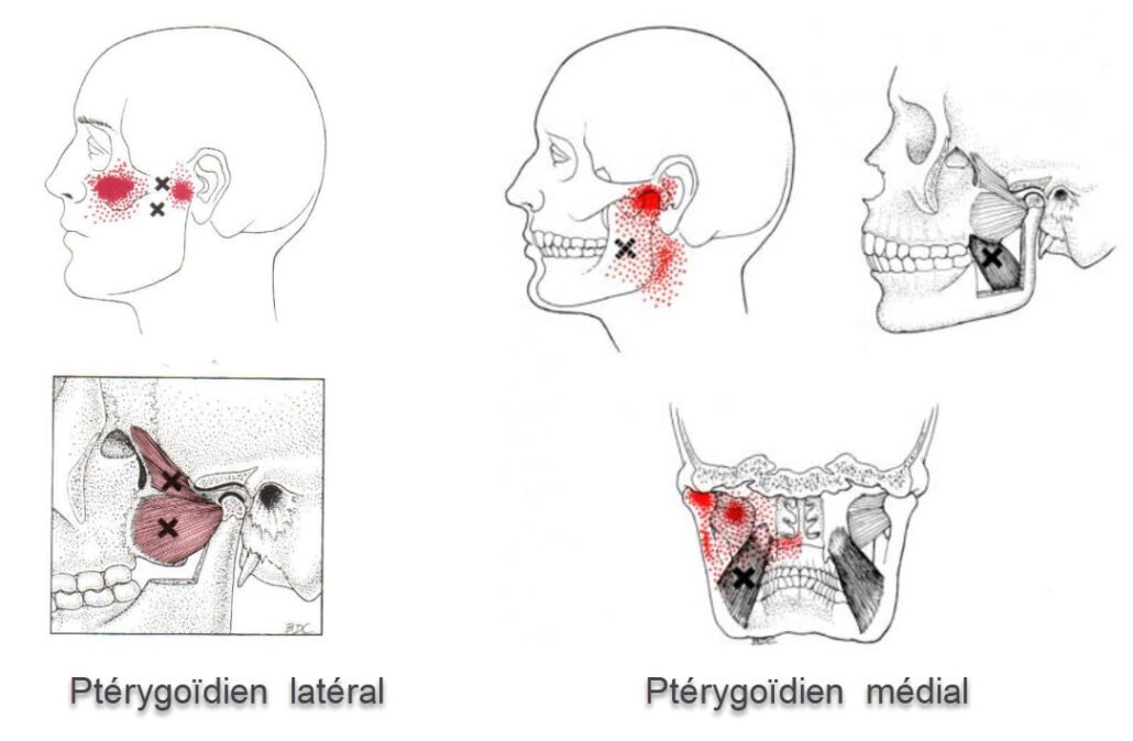 Osteopathic Treatment for Temporomandibular Joint Disorders | OsteoMag
