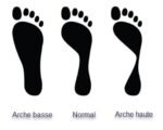 Understanding Foot Pronation Syndrome: Mechanisms, Risk Factors and ...