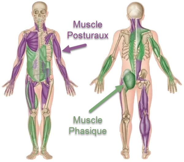 Syndrome du déséquilibre musculaire croisé de Janda - OsteoMag