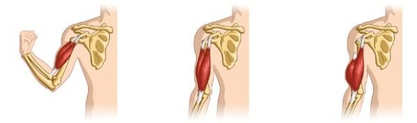 Proximal Biceps Tendon Ruptures - OsteoMag