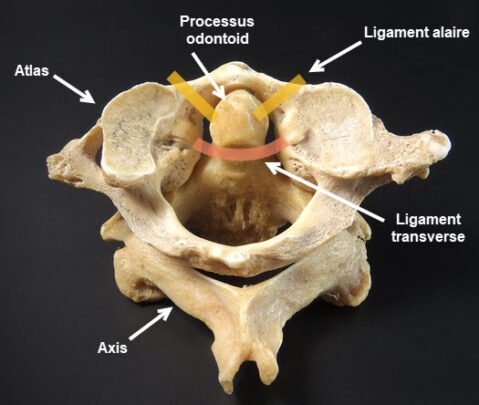 Instabilité Atlanto-Axiale : Causes, Symptômes et Solutions - OsteoMag