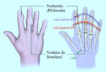 Arthrose de la Main : Symptômes, Causes et Approches Ostéopathiques ...