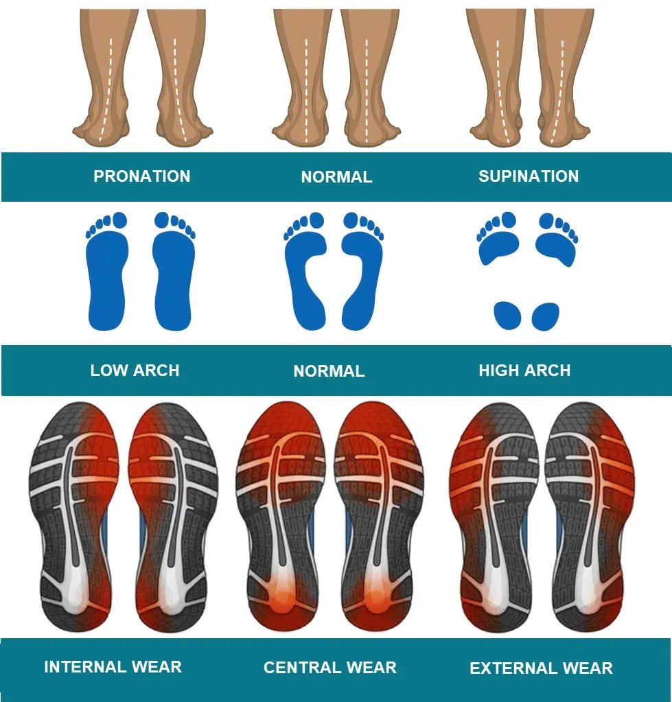 Analyzing Wear Patterns In Shoe Soles A Detailed Study OsteoMag Analyzing Wear Patterns In Shoe Soles A Detailed Study OsteoMag